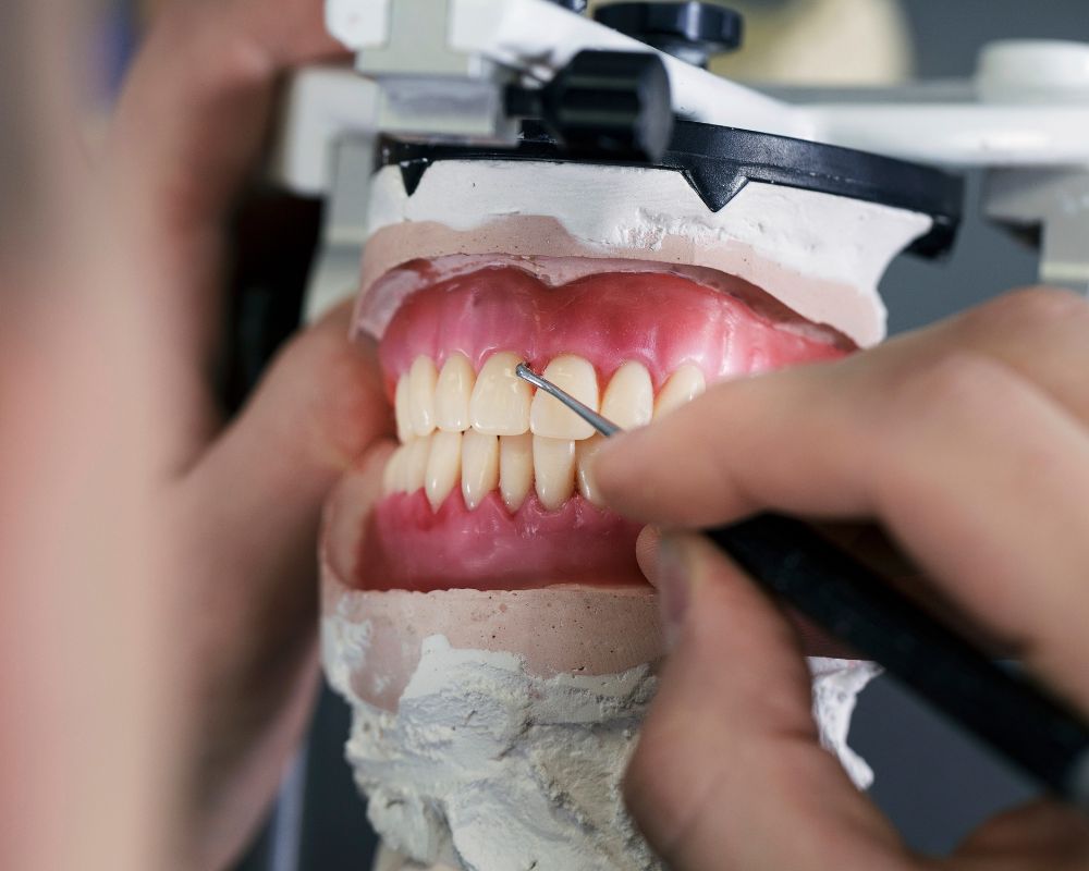 Adjusting to New Dentures: What to Expect in the First Few Weeks
